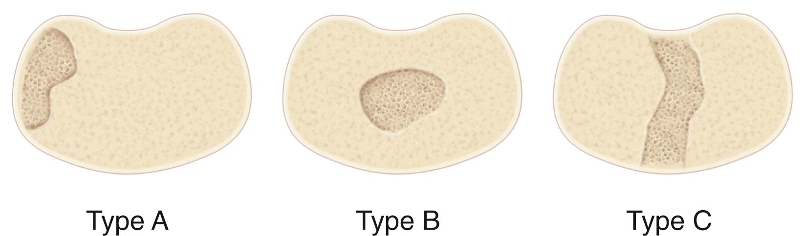 General Principles of Managing Orthopaedic Injuries - Clinical Tree