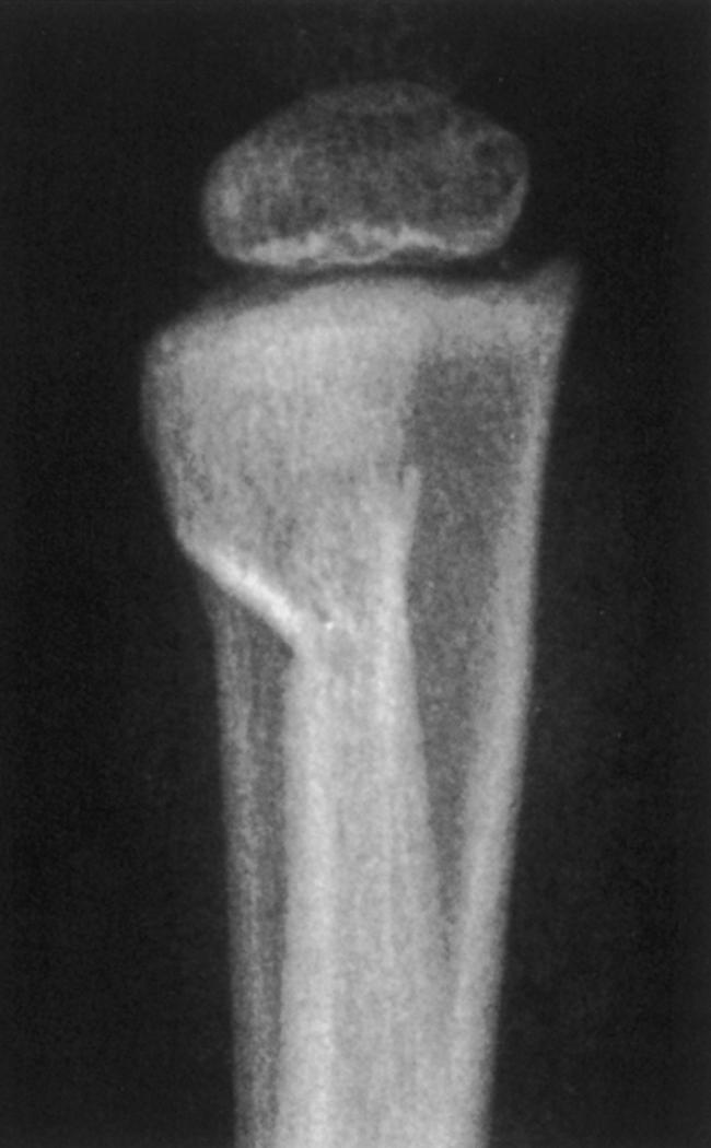 General Principles of Managing Orthopaedic Injuries - Clinical Tree