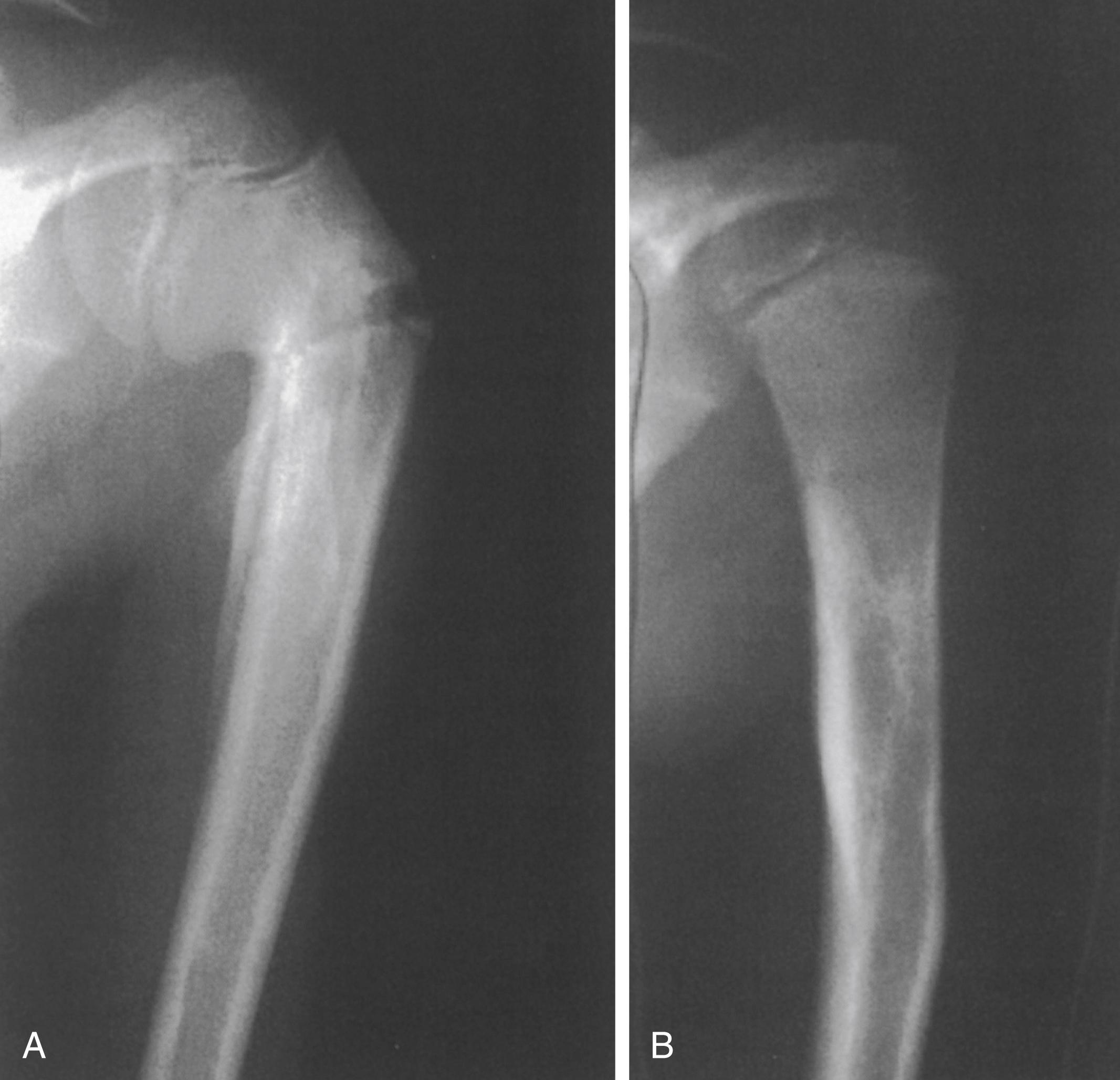 General Principles of Managing Orthopaedic Injuries - Clinical Tree