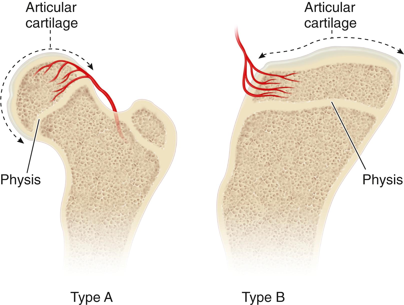 General Principles of Managing Orthopaedic Injuries - Clinical Tree