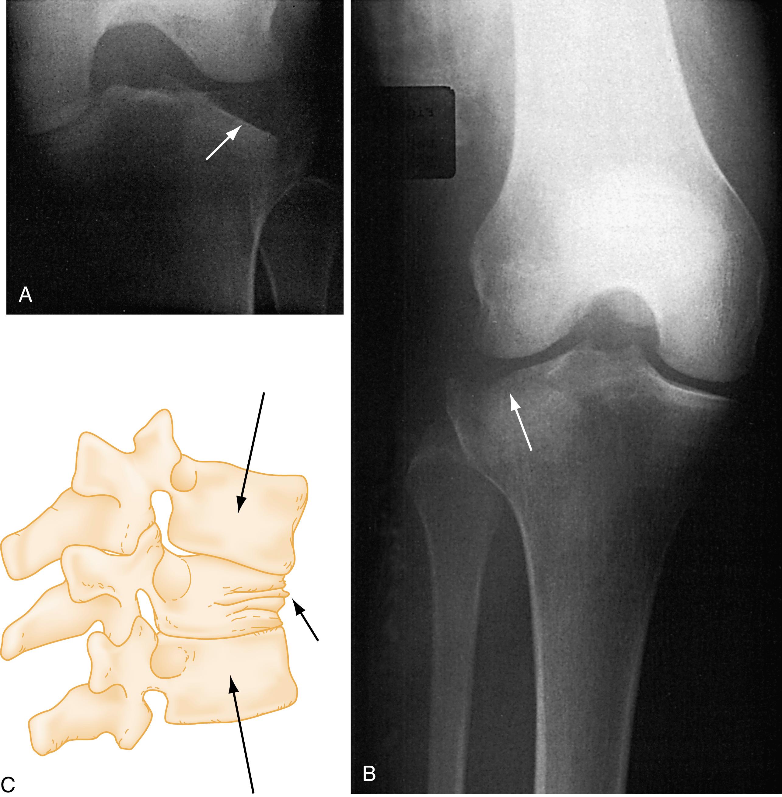 General Principles of Orthopedic Injuries - Clinical Tree