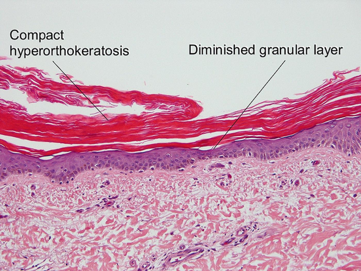 Genodermatoses - Clinical Tree