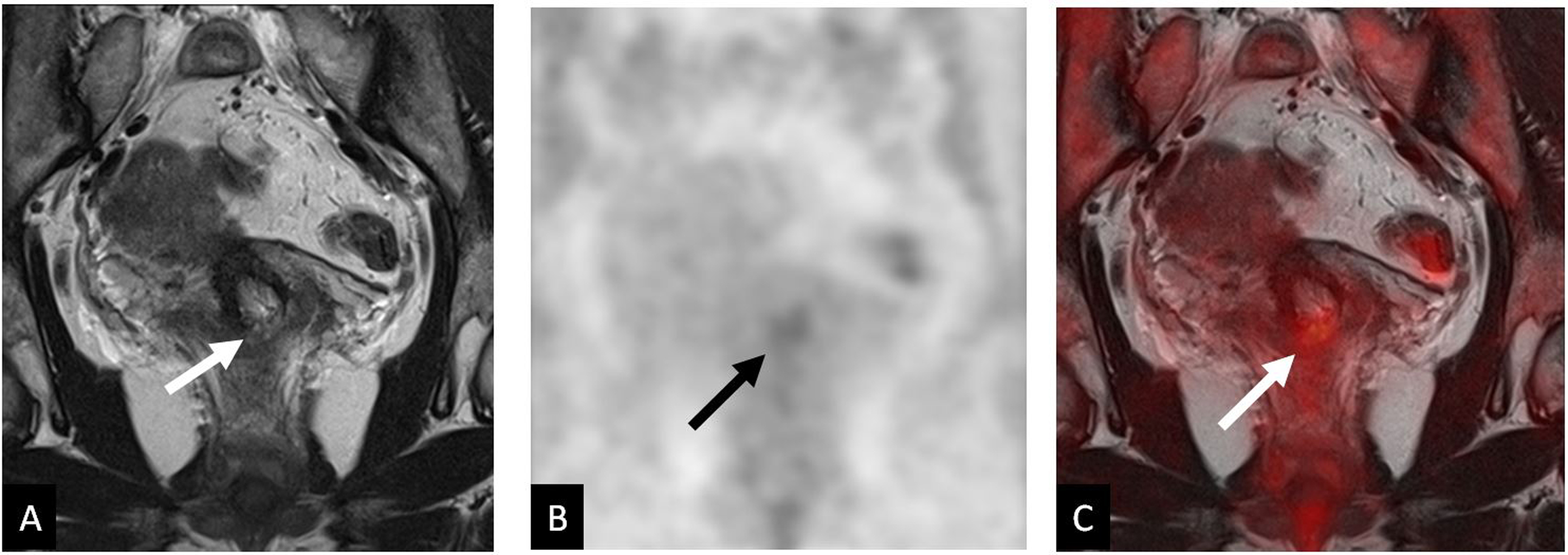 Gynecologic imaging - Clinical Tree