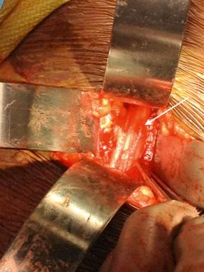 Hamstring Injuries - Clinical Tree