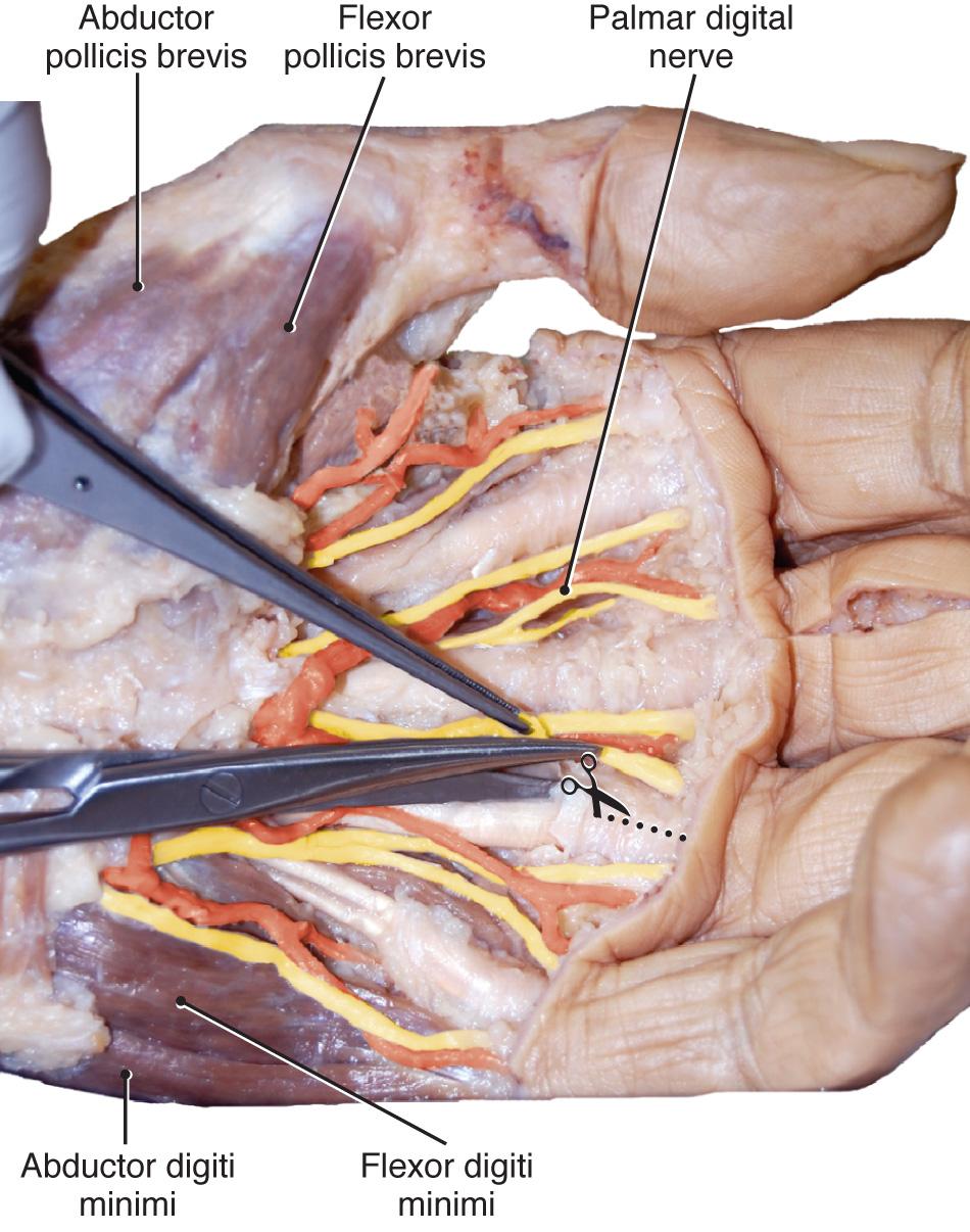 Hand - Clinical Tree