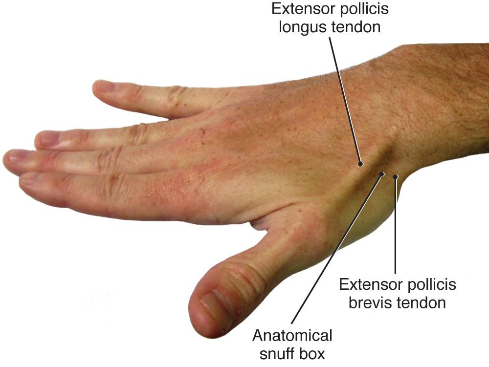 Hand - Clinical Tree