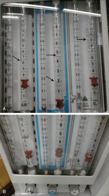 Hazards of the Anesthesia Delivery System - Clinical Tree
