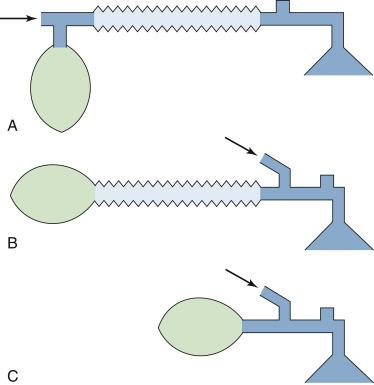 Hazards of the Anesthesia Delivery System - Clinical Tree