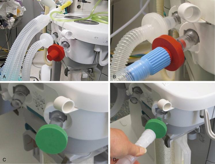 Hazards of the Anesthesia Delivery System - Clinical Tree