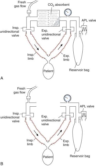 Hazards of the Anesthesia Delivery System - Clinical Tree