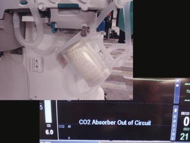 Hazards of the Anesthesia Delivery System - Clinical Tree