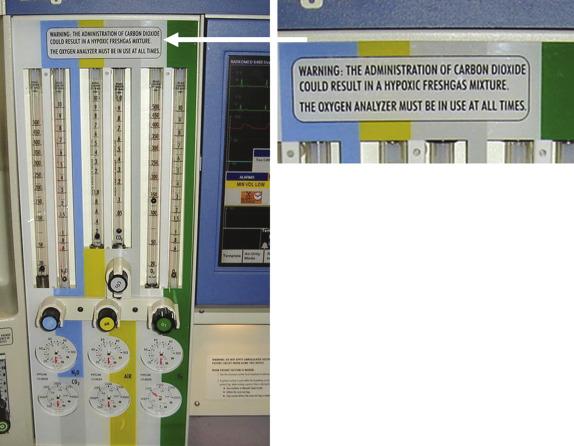Hazards of the Anesthesia Delivery System - Clinical Tree