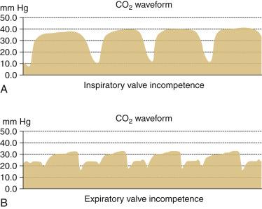 Hazards of the Anesthesia Delivery System - Clinical Tree