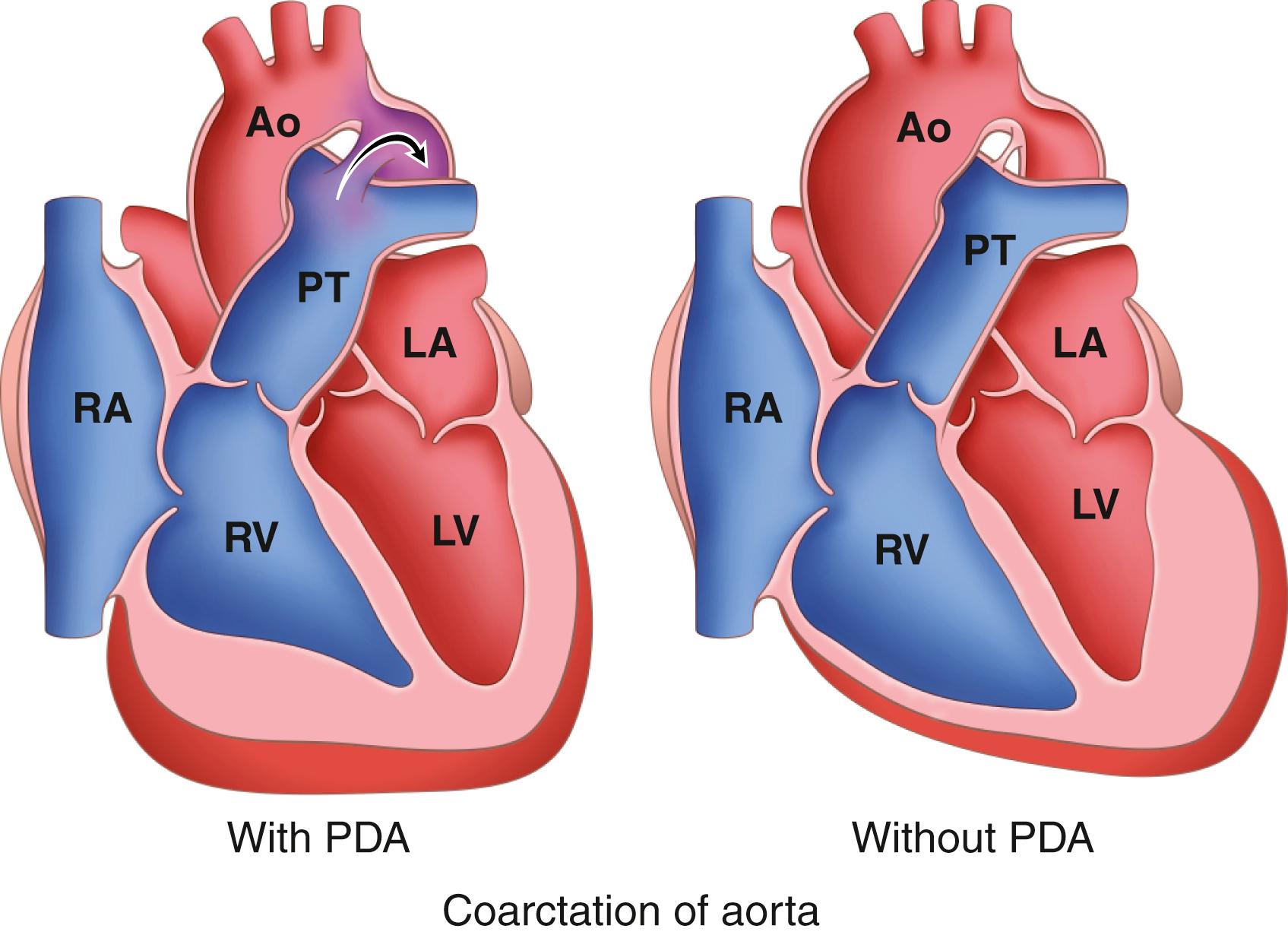Heart - Clinical Tree