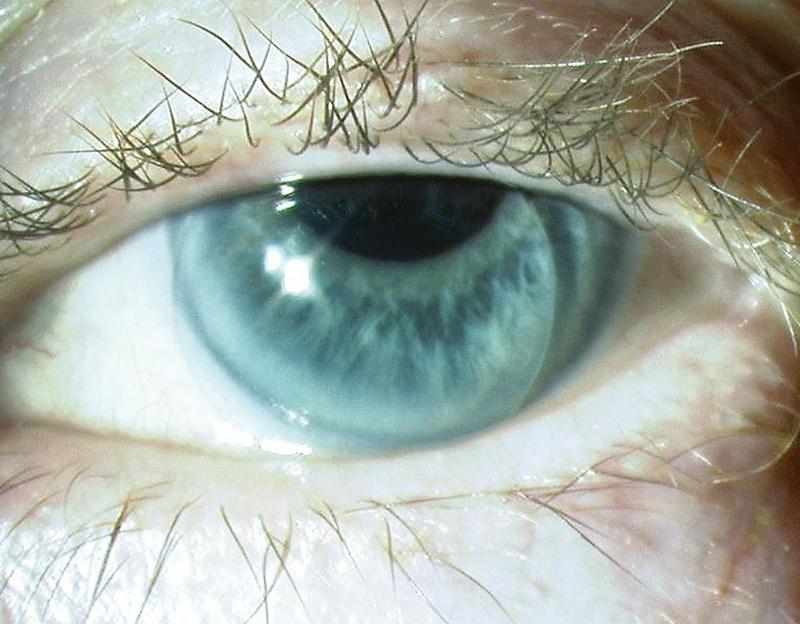 High Prescriptions - Clinical Tree