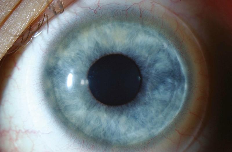 High Prescriptions - Clinical Tree