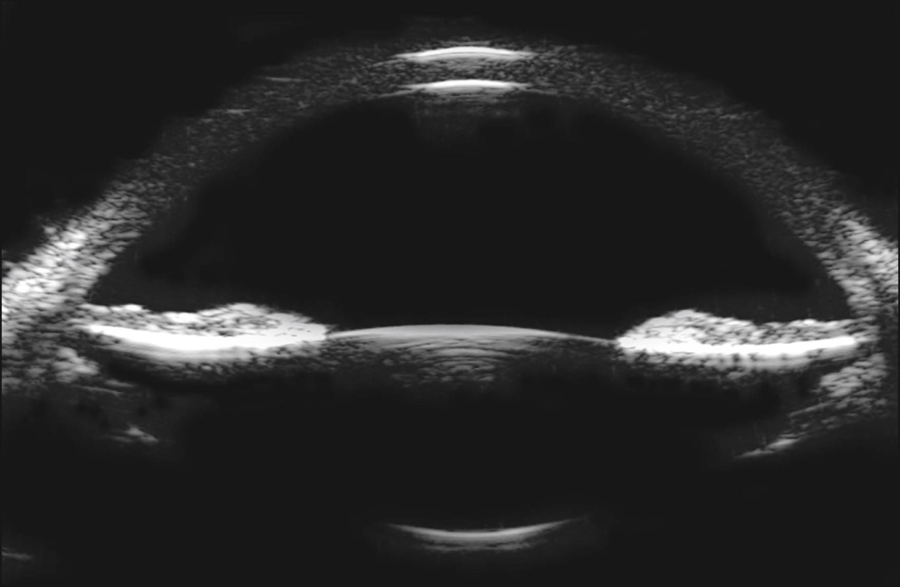 High-Resolution Ultrasound - Clinical Tree