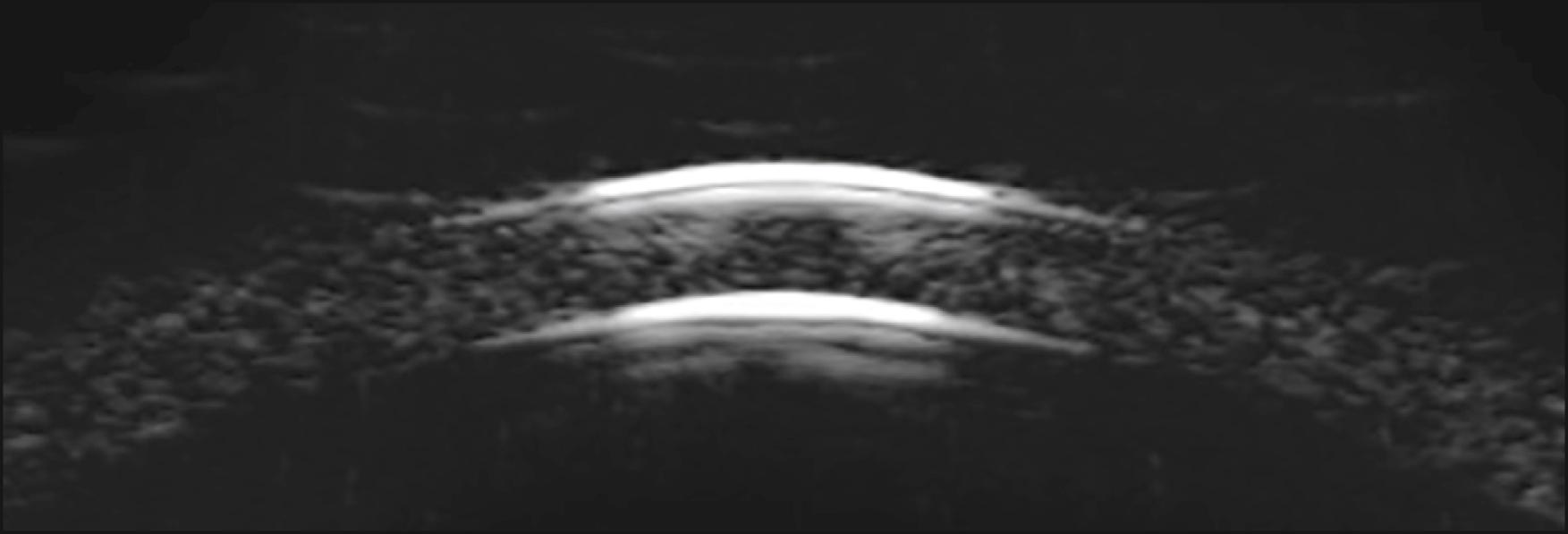 High-Resolution Ultrasound - Clinical Tree