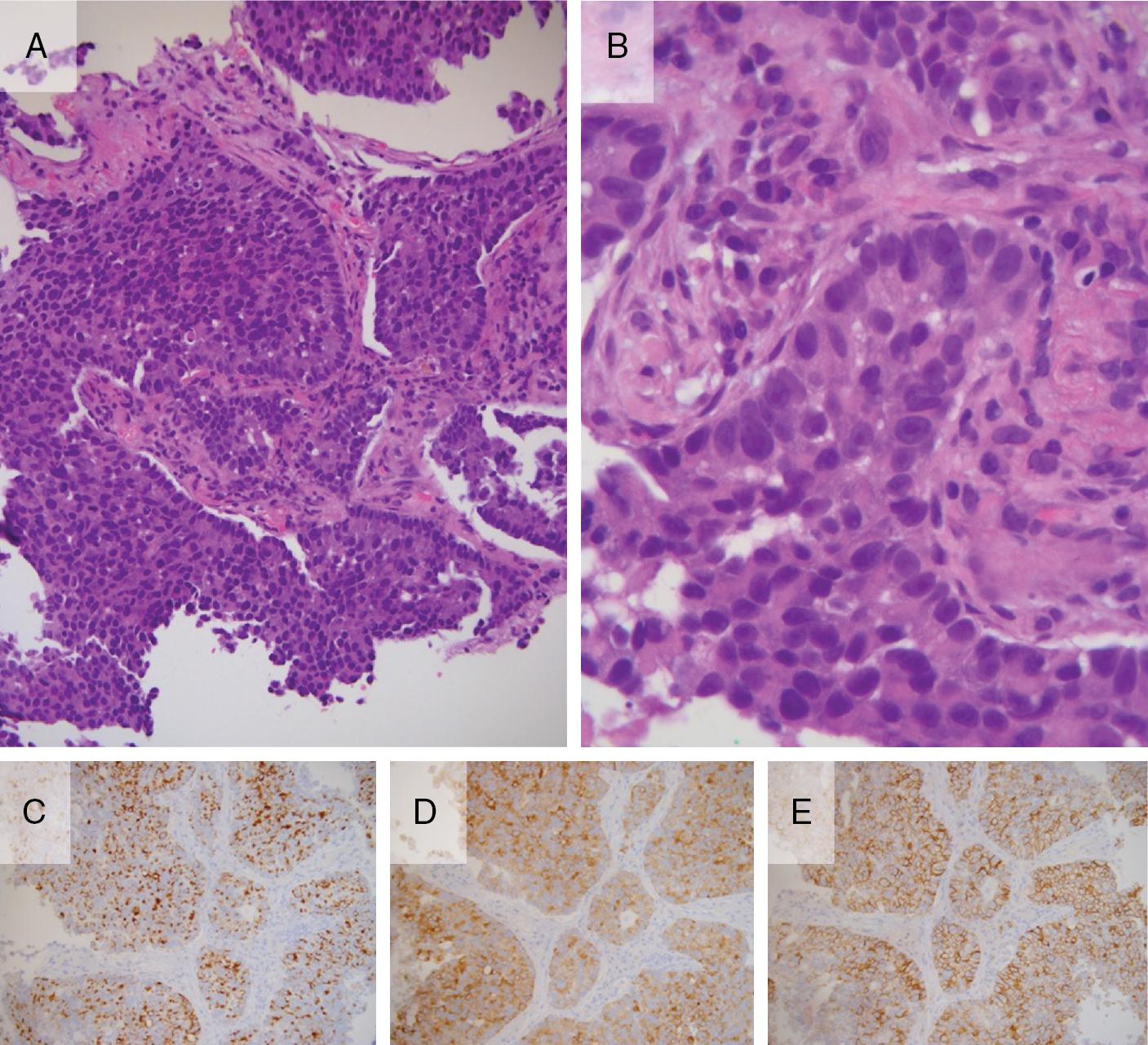 Histology and molecular testing - Clinical Tree