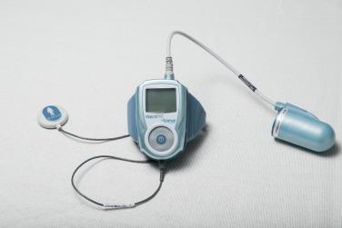 Home Sleep Testing - Clinical Tree