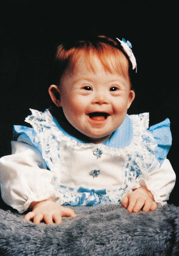 Human Birth Defects - Clinical Tree