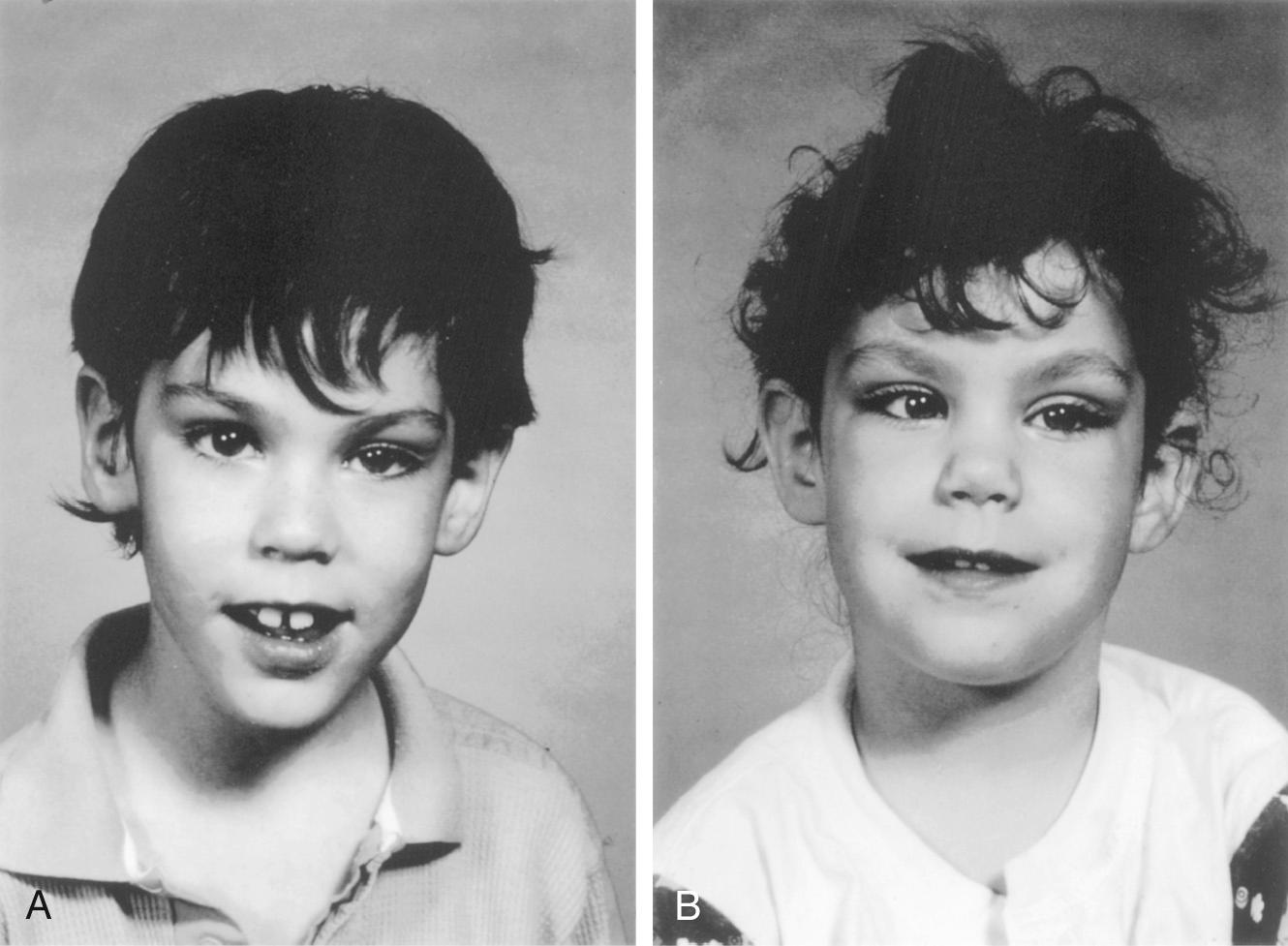 Human Birth Defects - Clinical Tree