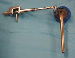 Humeral prosthetic positioning - Clinical Tree