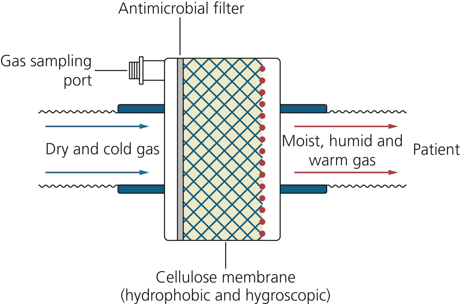 Humidification and filtration - Clinical Tree