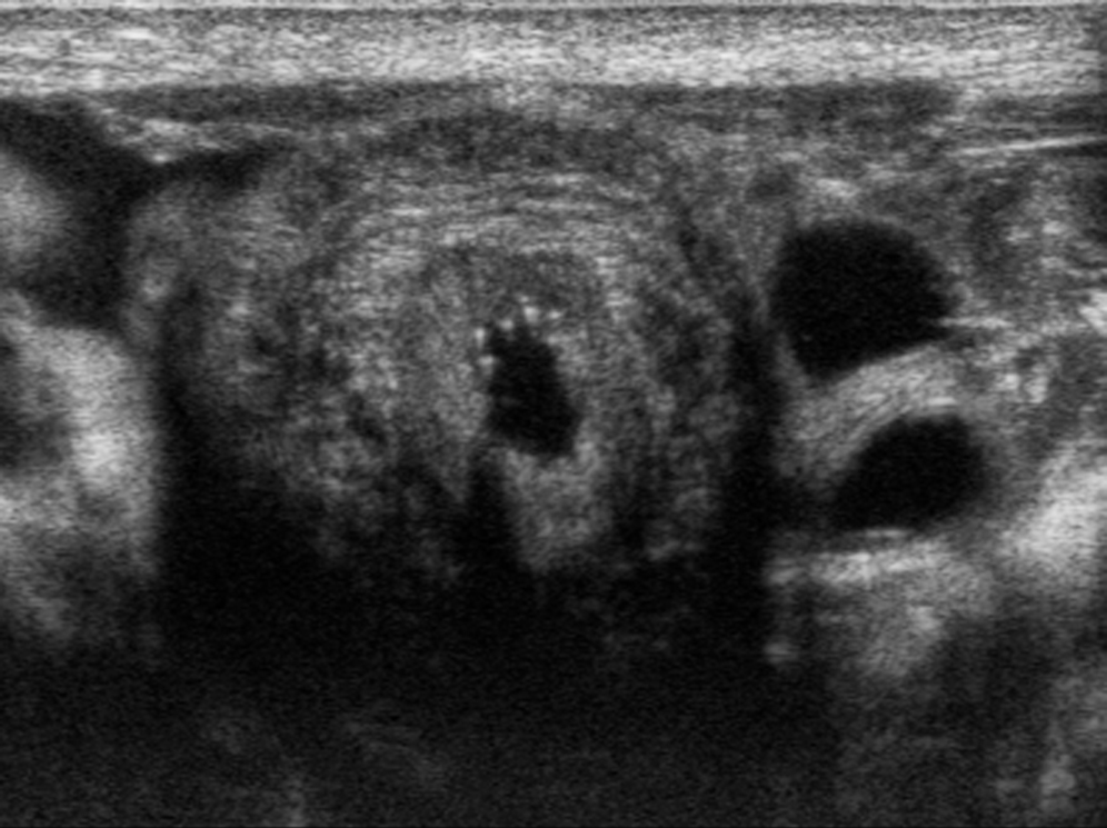 Imaging Approach to Urinary Tract Dilation - Clinical Tree