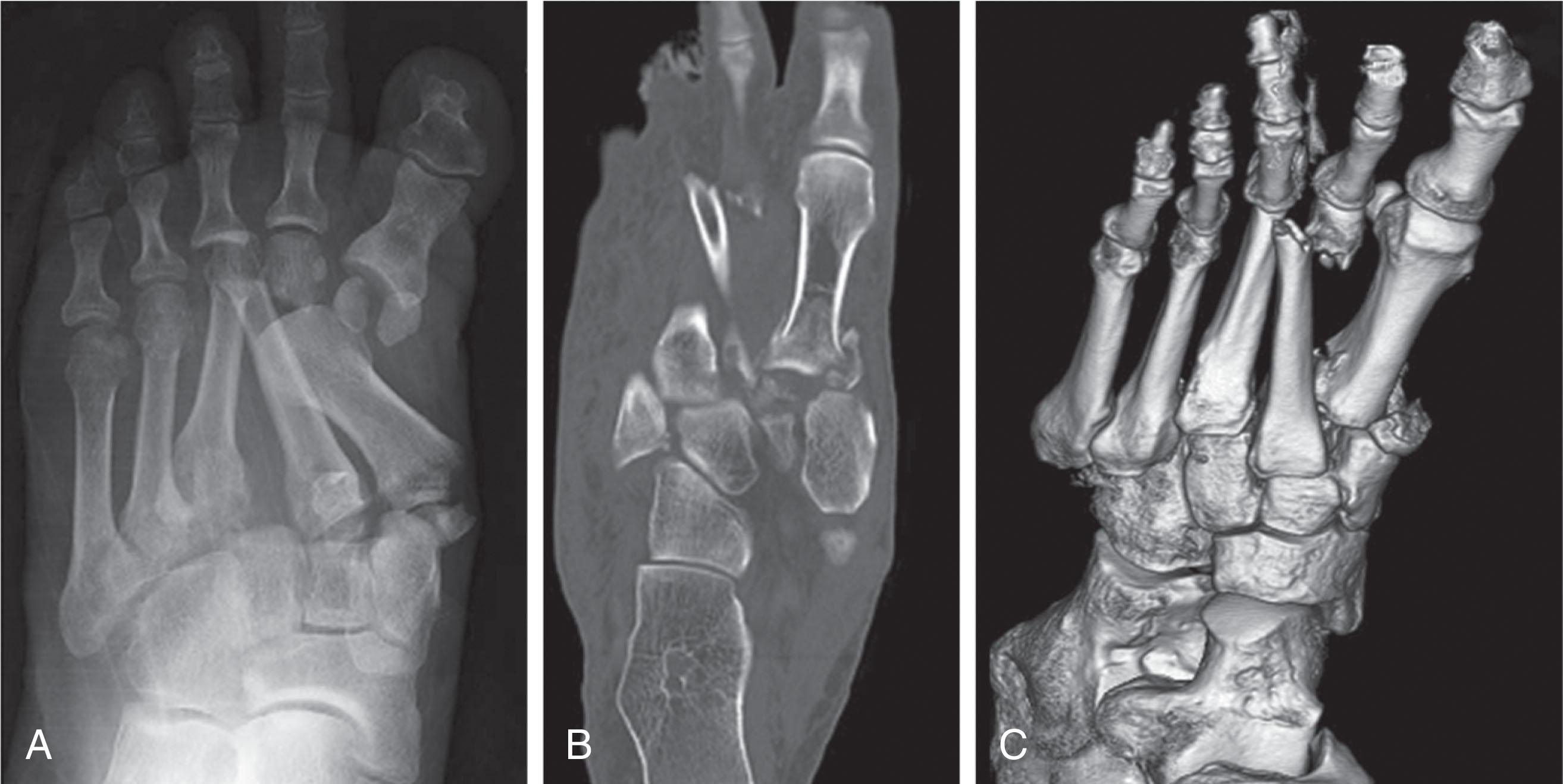 Imaging of the Foot and Ankle - Clinical Tree