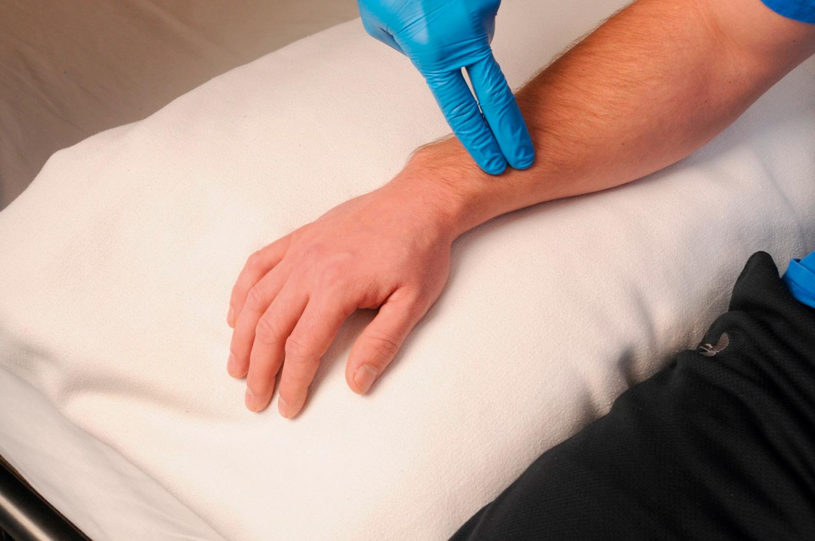 Injection Technique for Intersection Syndrome - Clinical Tree Injection Technique for Intersection Syndrome - Clinical Tree