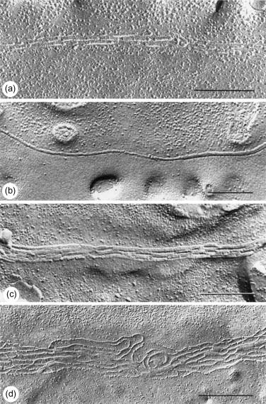Intercellular Junctions - Clinical Tree