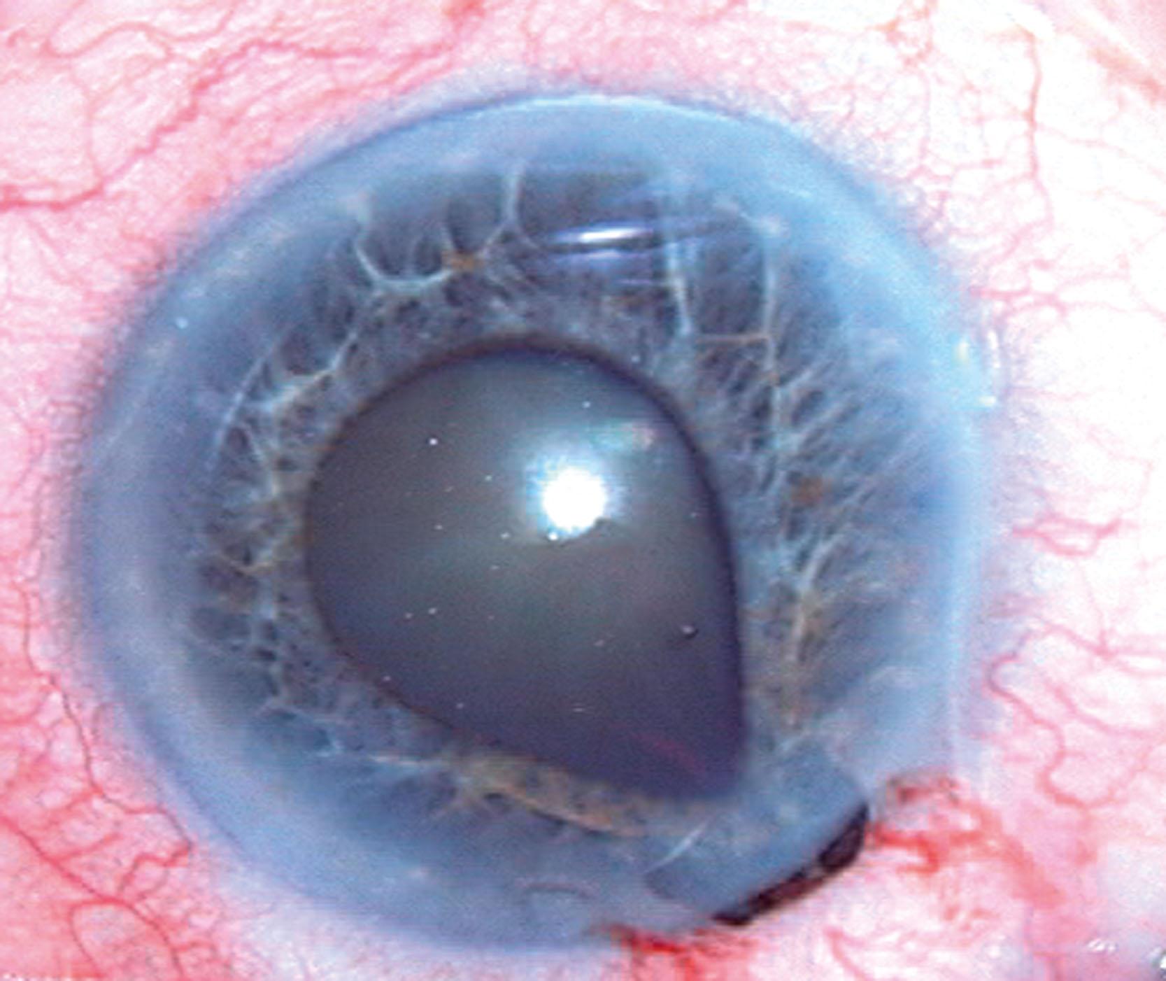 Intraoperative Complications - Clinical Tree