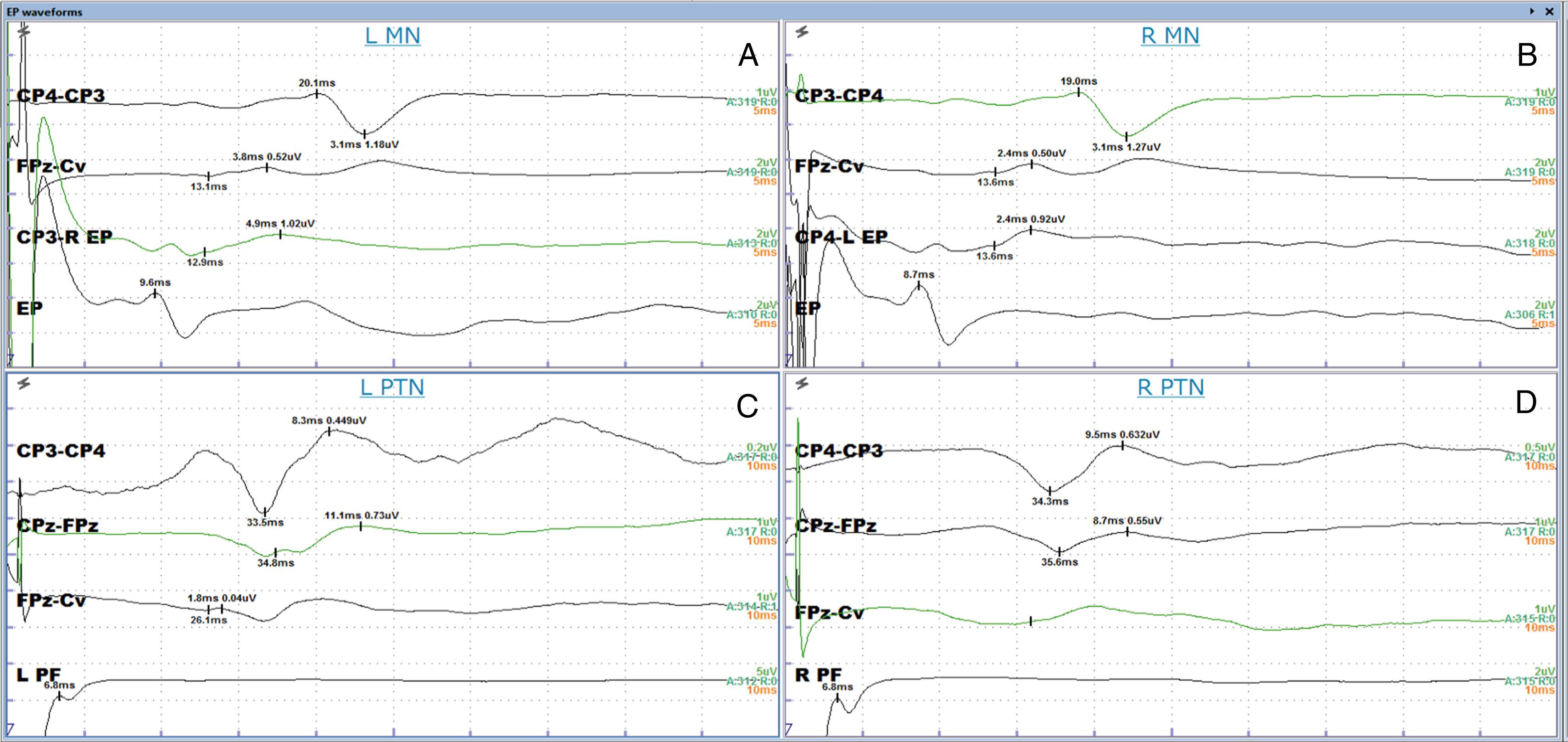 Intraoperative Monitoring in Routine and Complex Surgery - Clinical Tree