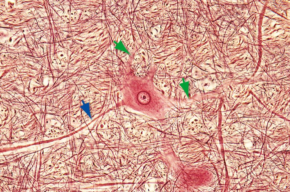 Introduction to the Nervous System - Clinical Tree