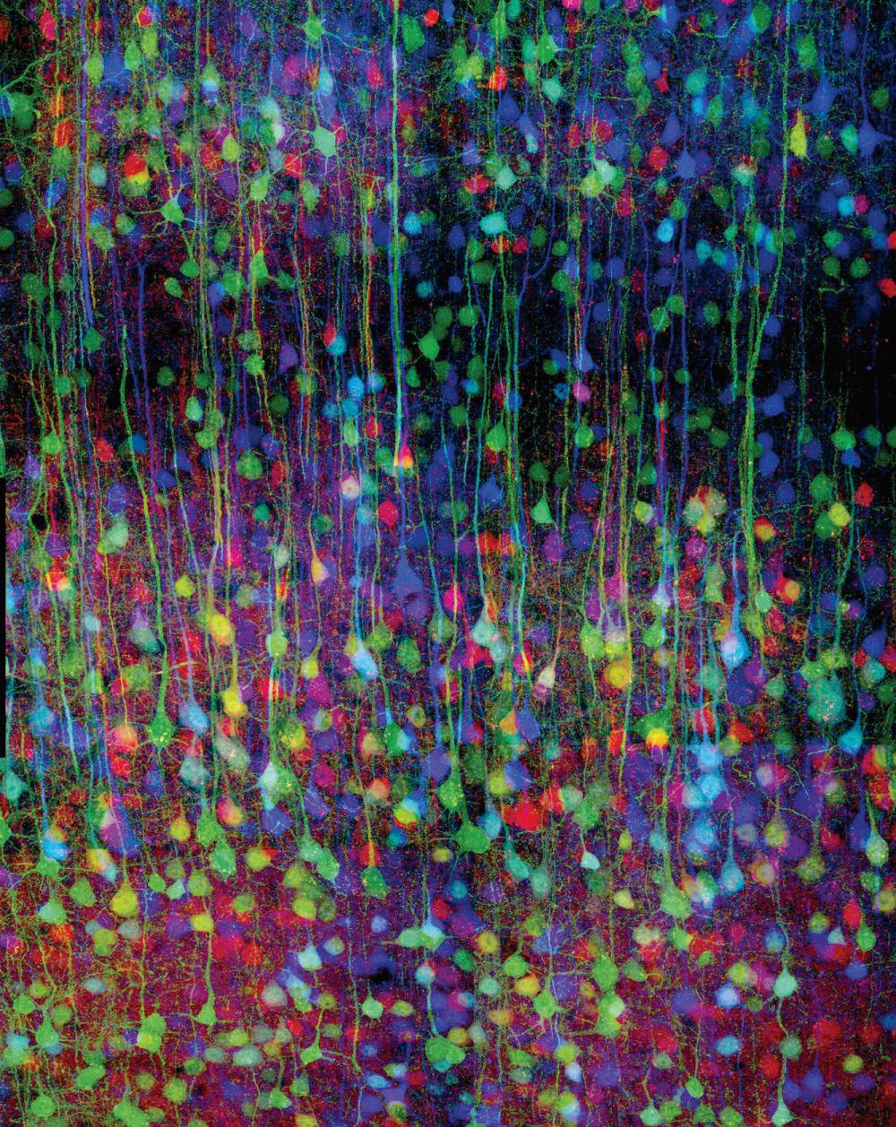 Introduction to the Nervous System - Clinical Tree
