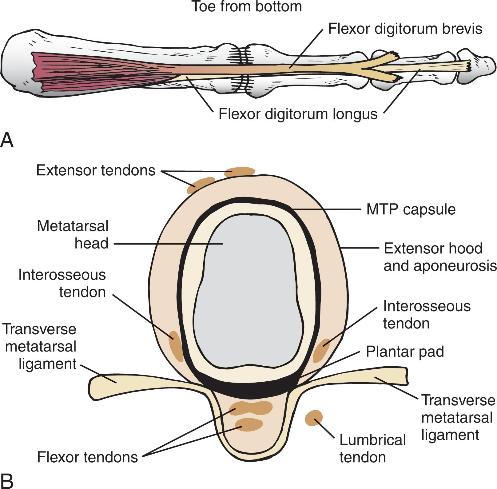 Lesser Toe Deformities - Clinical Tree