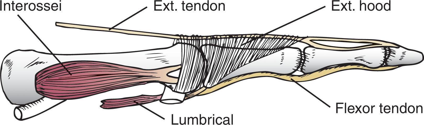 Lesser Toe Deformities - Clinical Tree