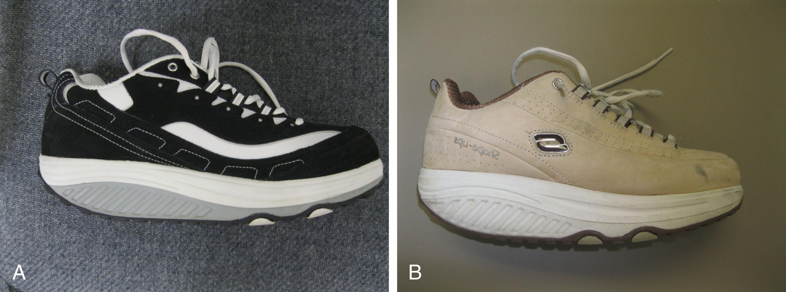 Lesser Toe Deformities - Clinical Tree