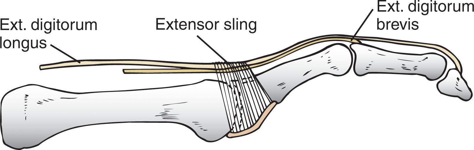 Lesser Toe Deformities - Clinical Tree