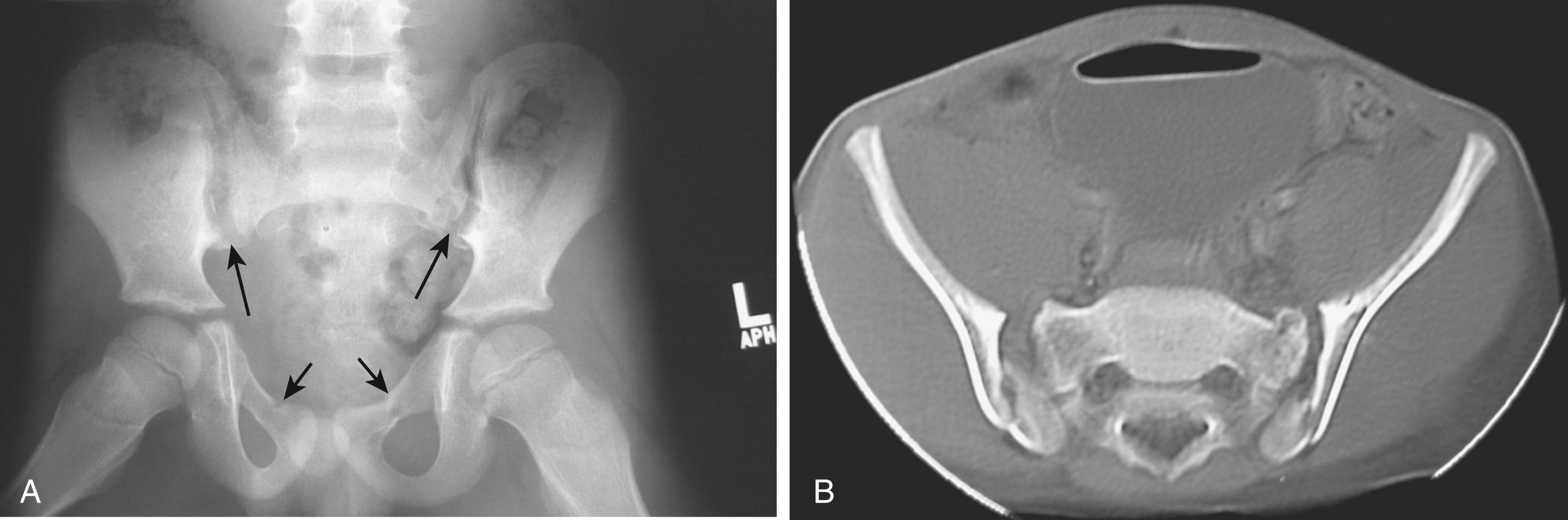 Lower Extremity Injuries - Clinical Tree