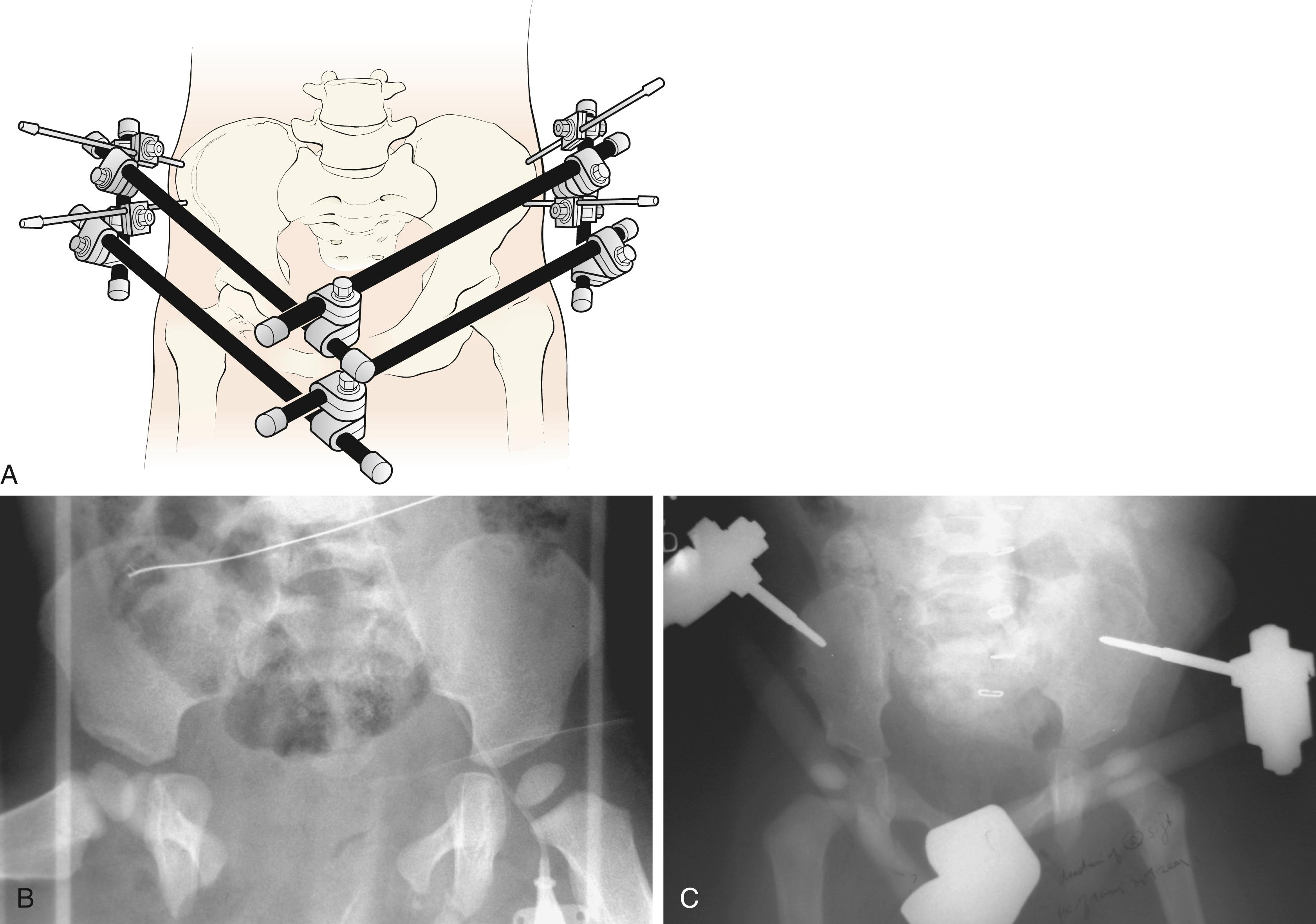 Lower Extremity Injuries - Clinical Tree