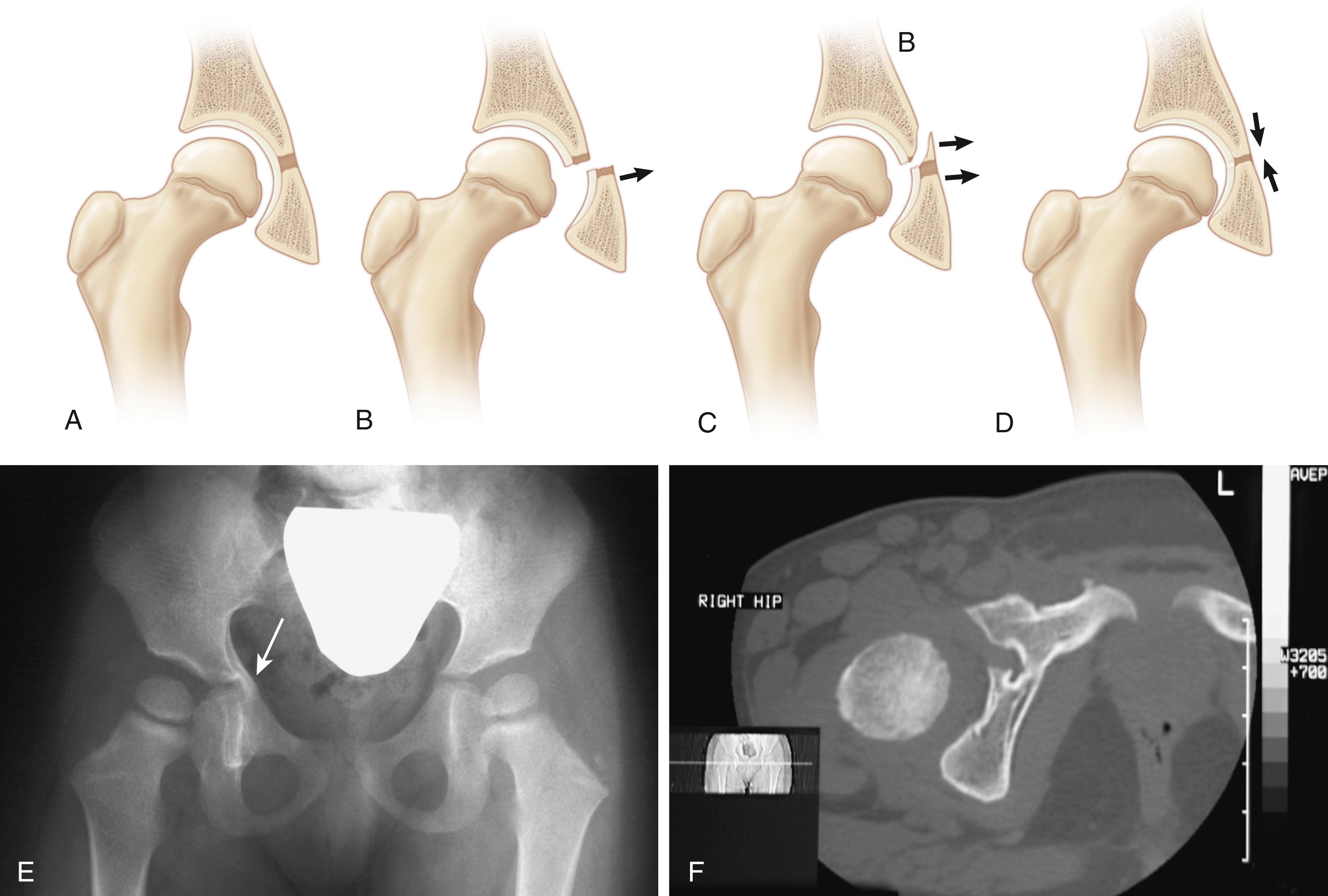 Lower Extremity Injuries - Clinical Tree