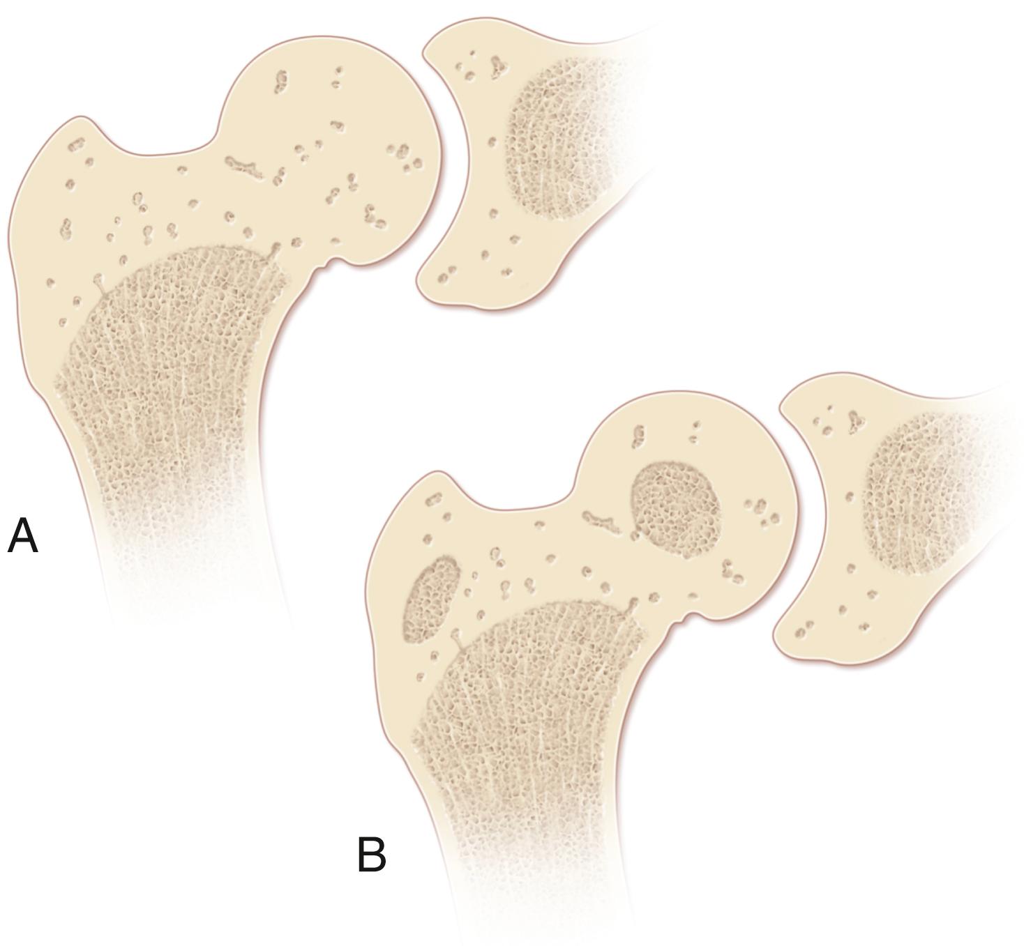 Lower Extremity Injuries - Clinical Tree