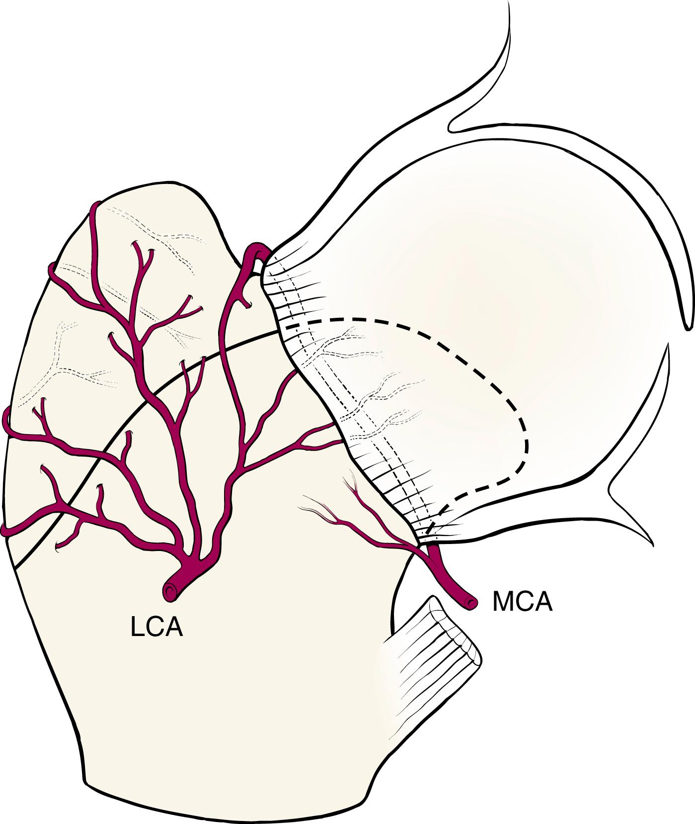 Lower Extremity Injuries - Clinical Tree