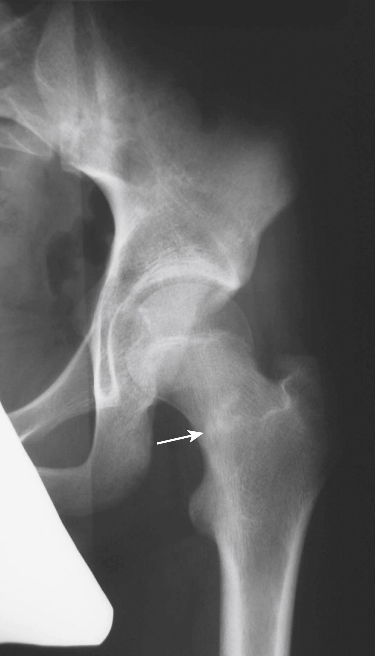 Lower Extremity Injuries - Clinical Tree