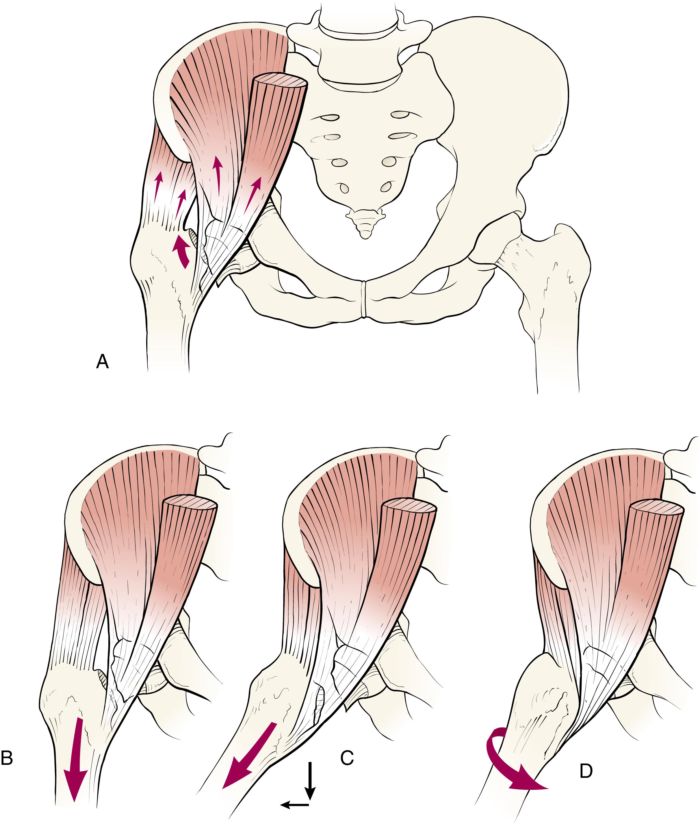 Lower Extremity Injuries - Clinical Tree