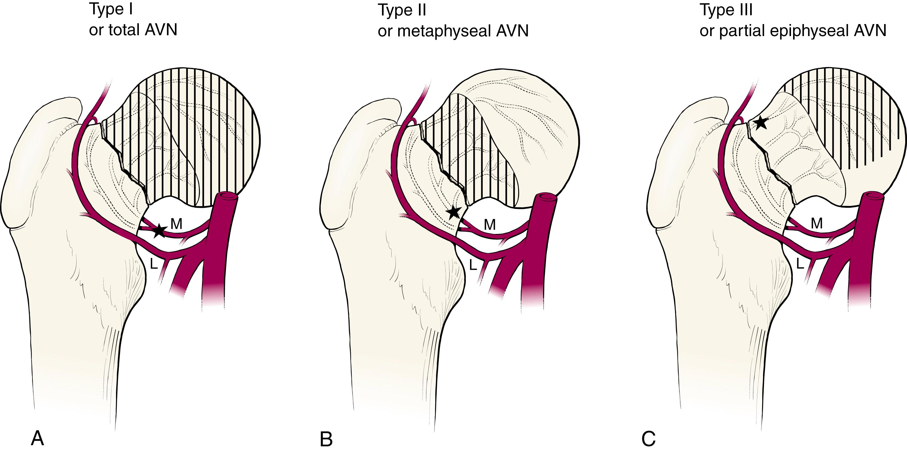 Lower Extremity Injuries - Clinical Tree