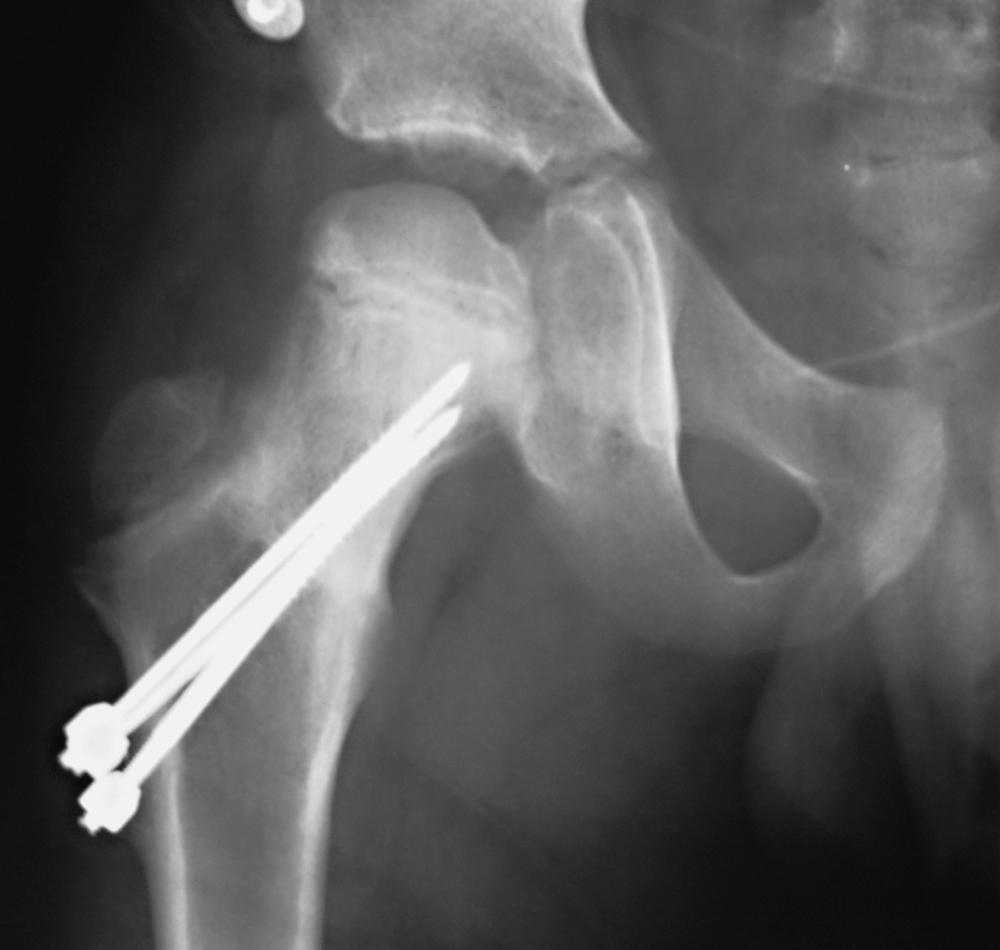 Lower Extremity Injuries - Clinical Tree