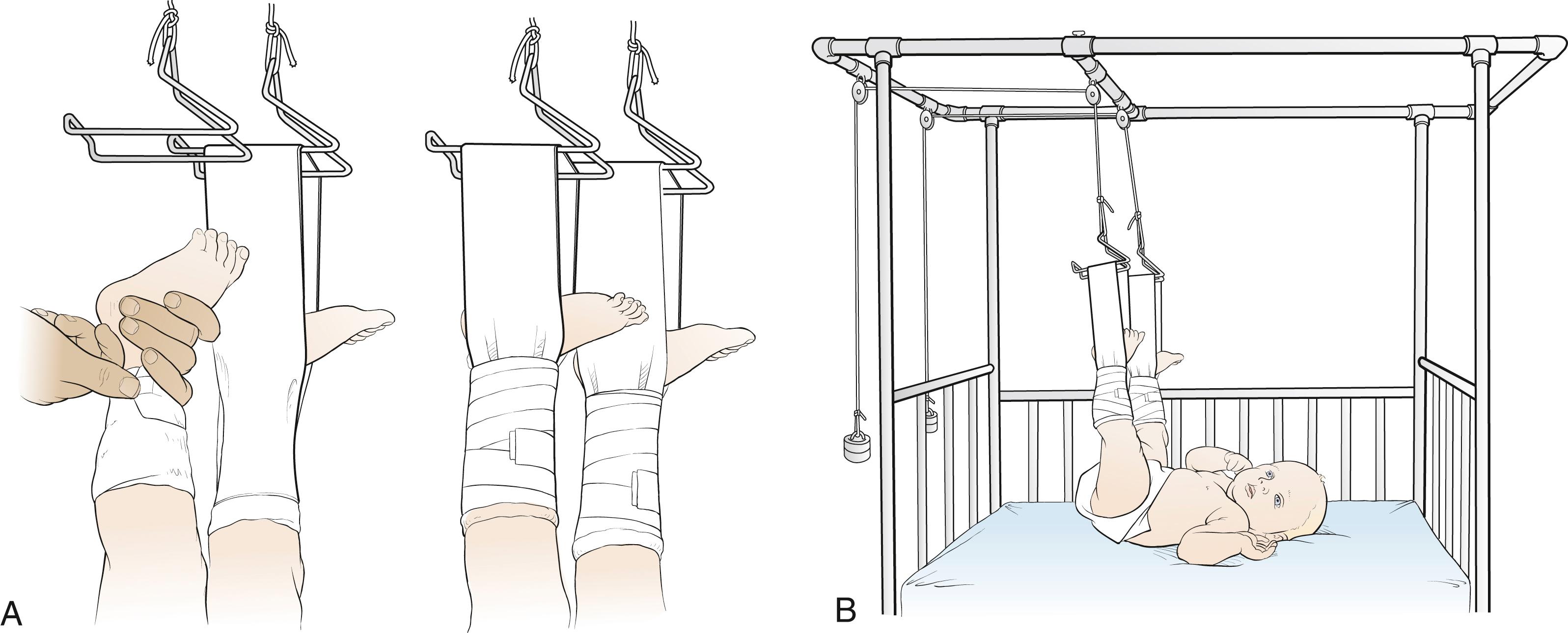 Lower Extremity Injuries - Clinical Tree